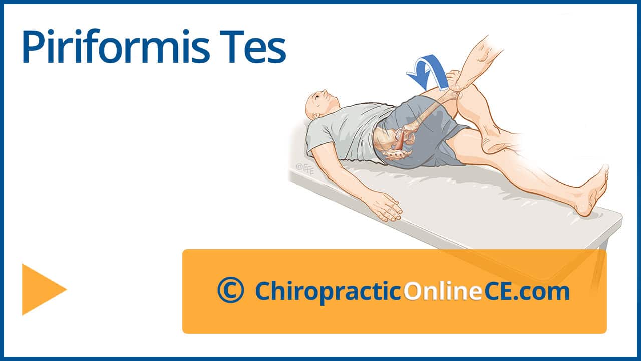 Piriformis Test