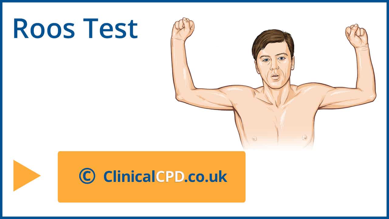 Costoclavicular Test