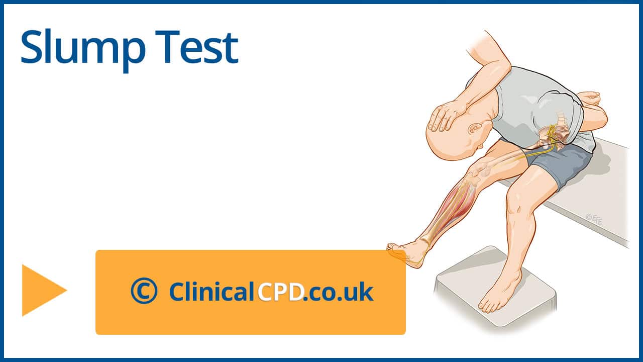 Slump Test Neural Tension
