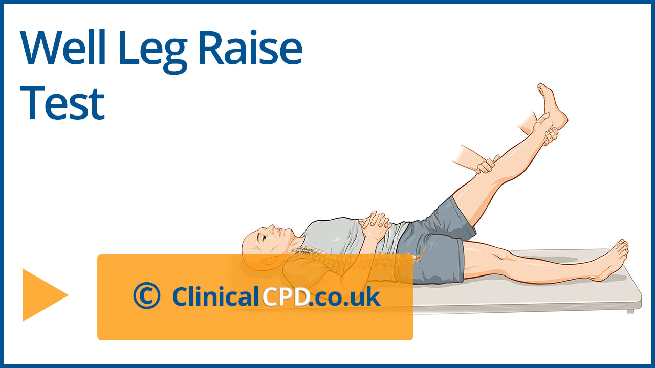 Lhermitte S Sign Test